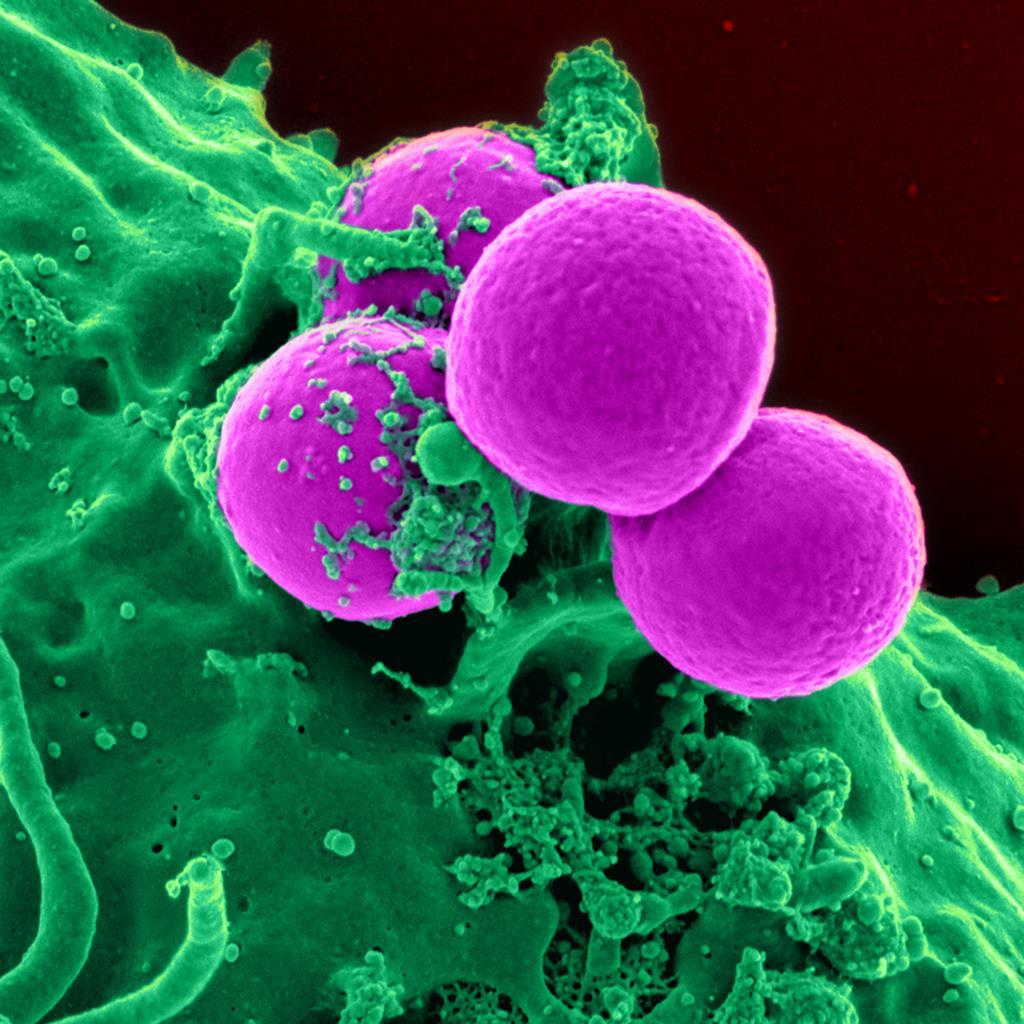 Under the microscope: the ESKAPE pathogens | Features | The Microbiologist