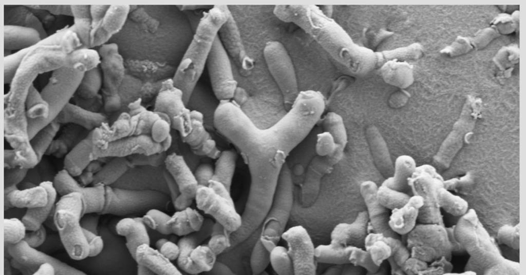 First contact: the importance of the early life microbiota | Features ...