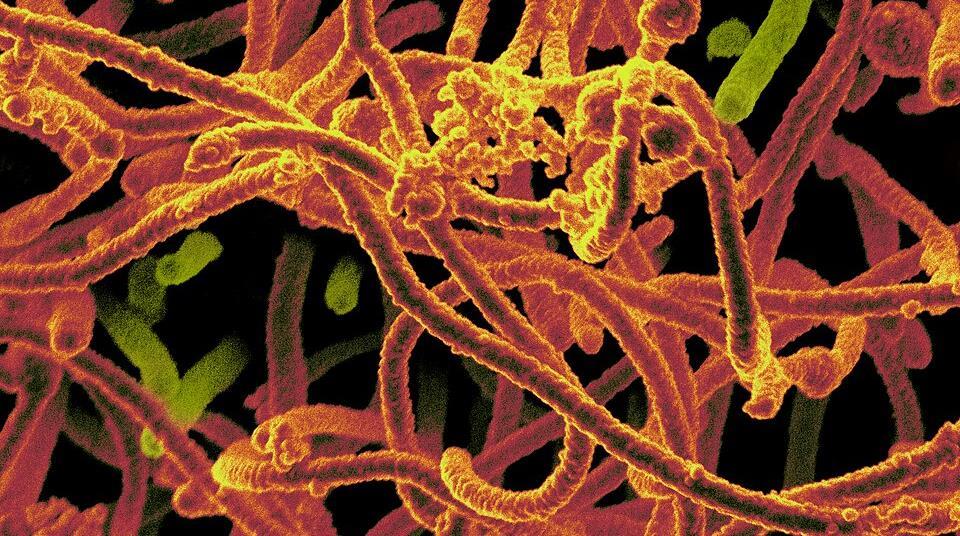 Ebola virus hides in the central nervous system, according to new ...