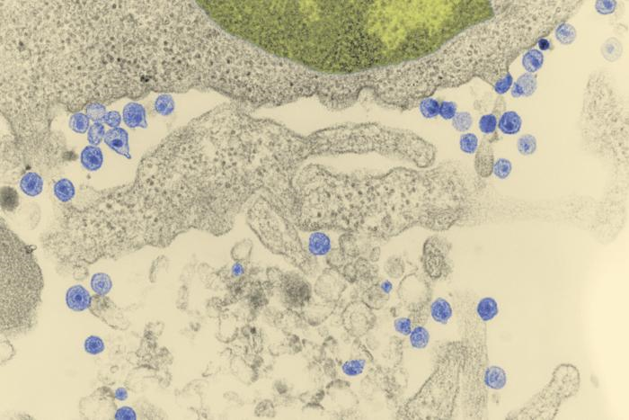 40 years after the discovery of HIV, research raises hopes of remission ...