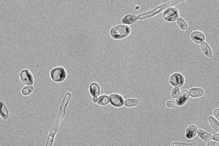 Single-celled fungi could assimilate CO2 and change the world | Careers ...