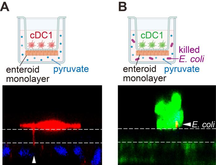 Study reveals how our gut cells detect harmful invaders | News | The ...