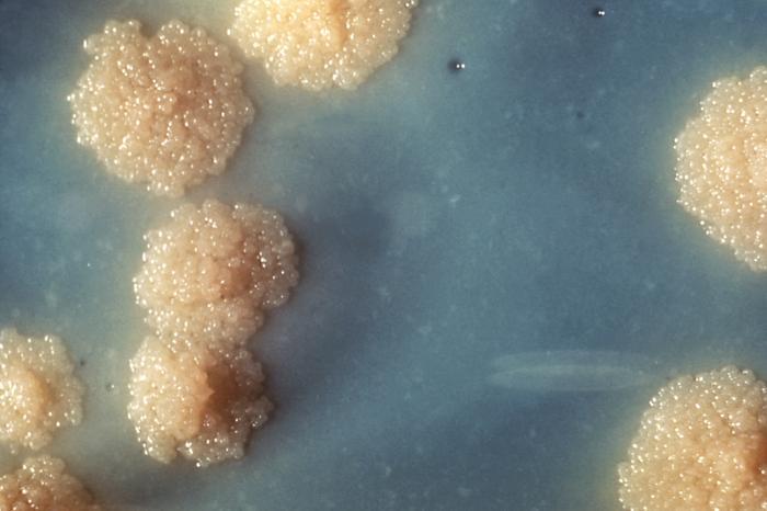 Point-of-care rapid tests can improve screening for latent tuberculosis ...