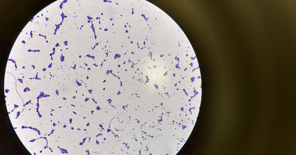 Scientists reveal search for faster way to diagnose MRSA and its ...