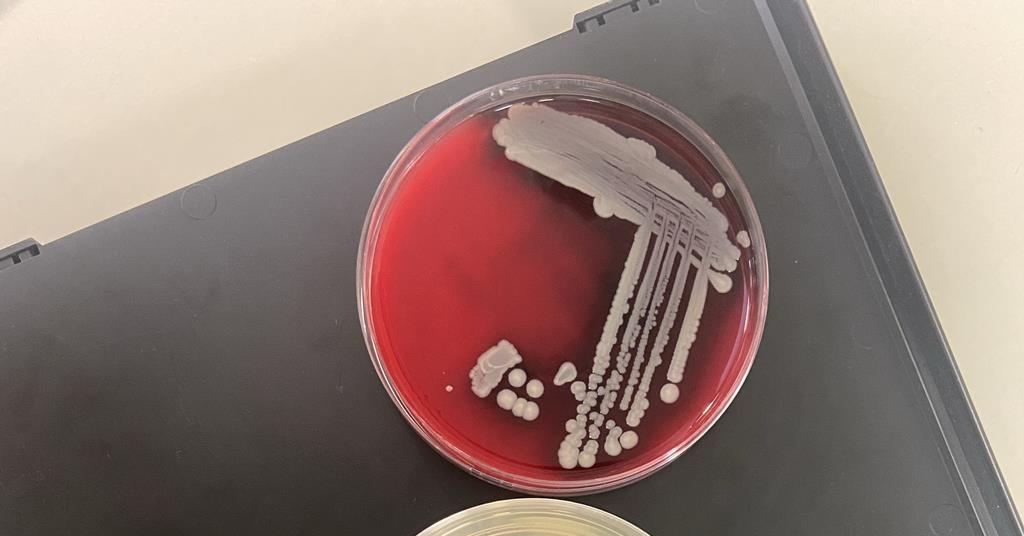 Scientists reveal search for faster way to diagnose MRSA and its ...