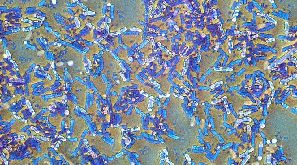 Microbial vanadate reduction: unveiling electron transfer and isotope ...