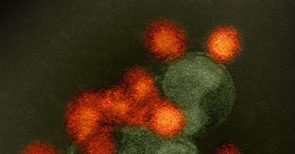 Stealth virus: Zika virus builds tunnels to covertly infect cells of ...
