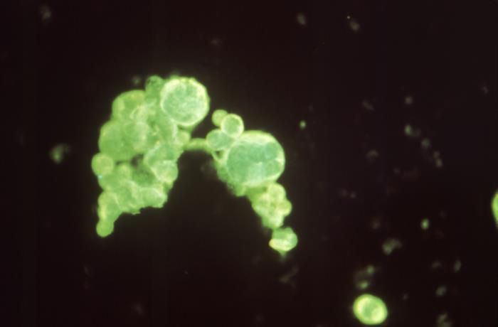 Silent intruder: How the cold sore virus maps its way through the brain ...