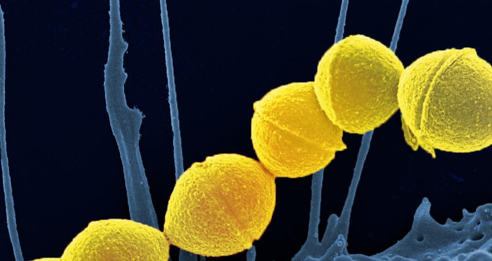 Nasal vaccine could be the new line of defence against Strep A | News ...