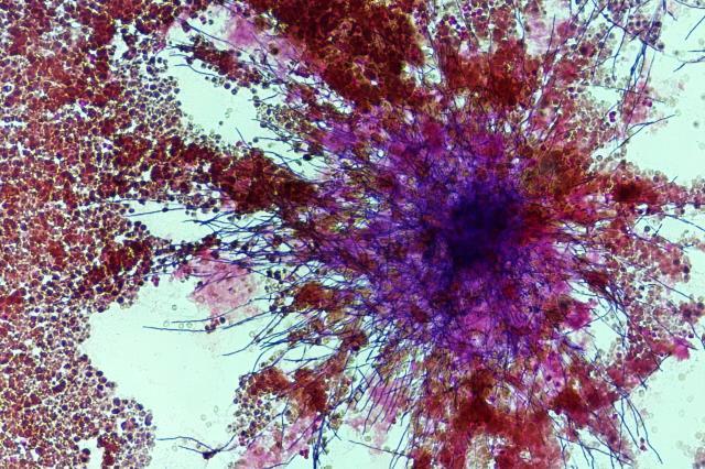 New vaccine works against multiple fungal infections | News | The ...