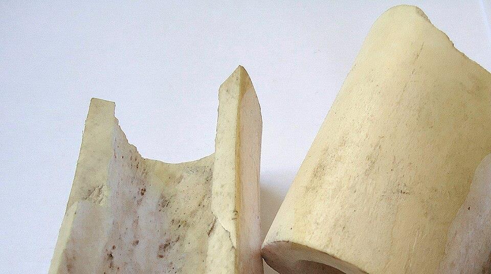 Researchers deploy yeast platform to turn urine into high-value bio-implant material | News ...