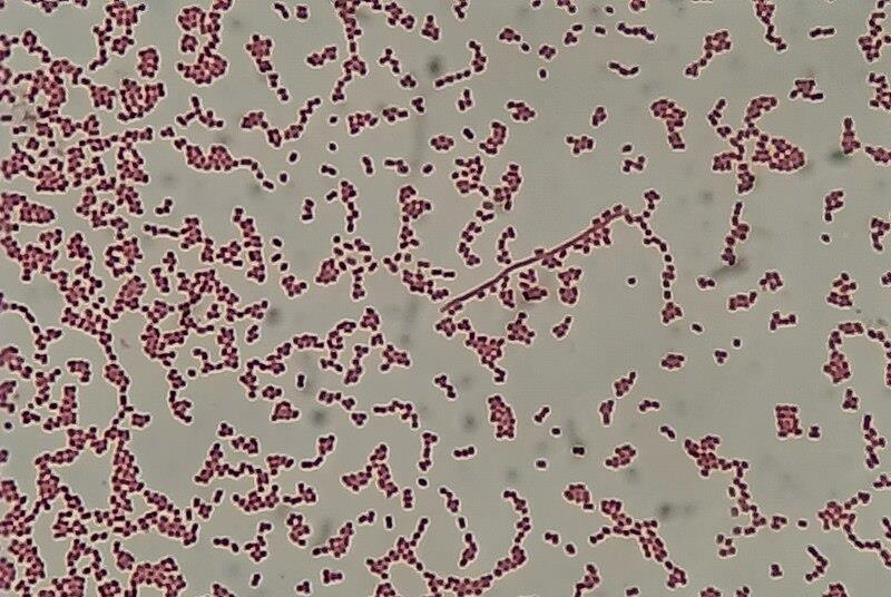 Researchers identify new tools for anti-Acinetobacter drug development ...