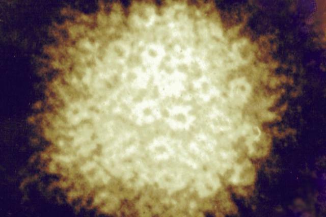 New 3D imaging approach reveals intricate steps of virus assembly ...