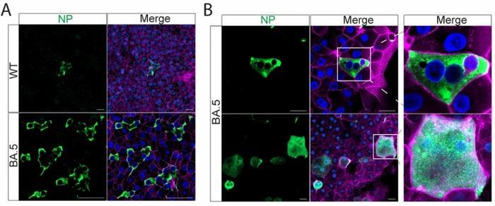 First human respiratory organoid culture system reveals secret of ...