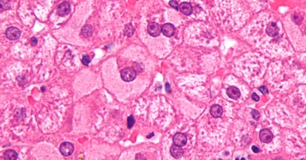 Under the microscope: viral hepatitis | Features | The Microbiologist