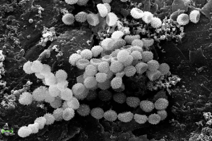 Microbes harnessed to remove and degrade indoor pollutants | News | The ...
