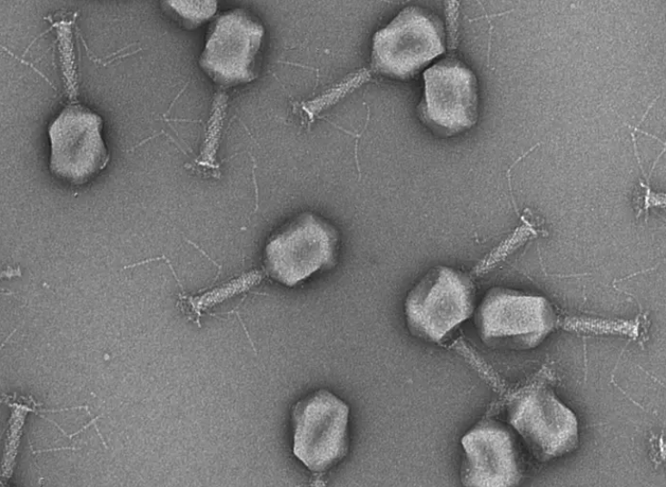 Rapid test for cystitis deploys phages to destroy pathogens | The ...