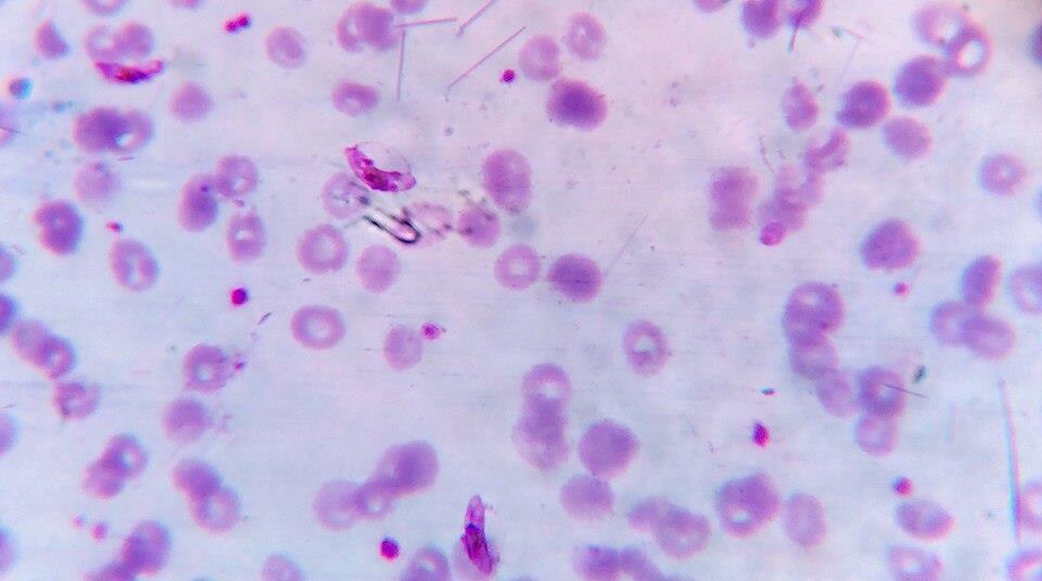Pair of malaria parasite proteins could lead to targeted therapies | News | The Microbiologist