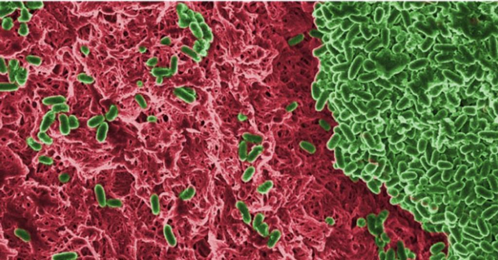 Your Pseudomonas aeruginosa biofilm may vary - depending on where it ...