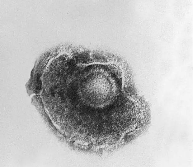 From dormant to danger: How VZV reactivation is driving CNS infections ...