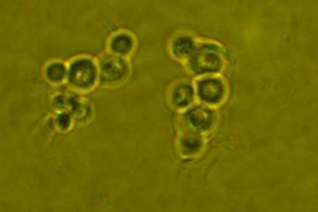 Researchers develop novel solution for Pichia pastoris enzyme ...