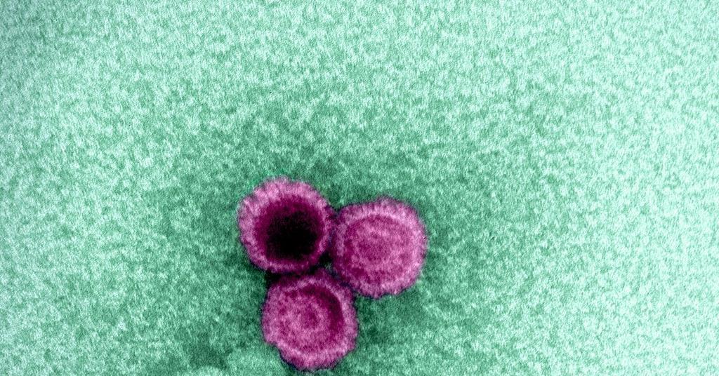 A surprising link between Crohn’s disease and the Epstein-Barr virus ...