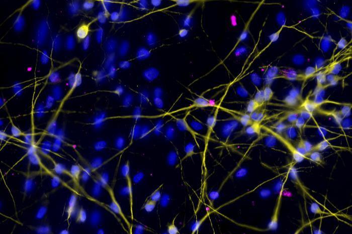 Zika virus vaccine emerges as an unlikely hero in battling brain cancer ...