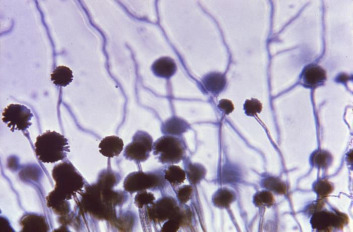 Deadly fungus beaten with treatment blocking fatty acid formation | The ...