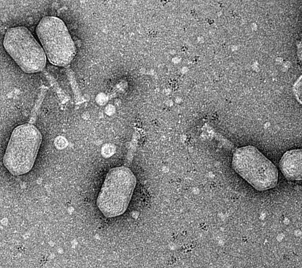 Scientists uncover new way viruses fight back against bacteria | News ...