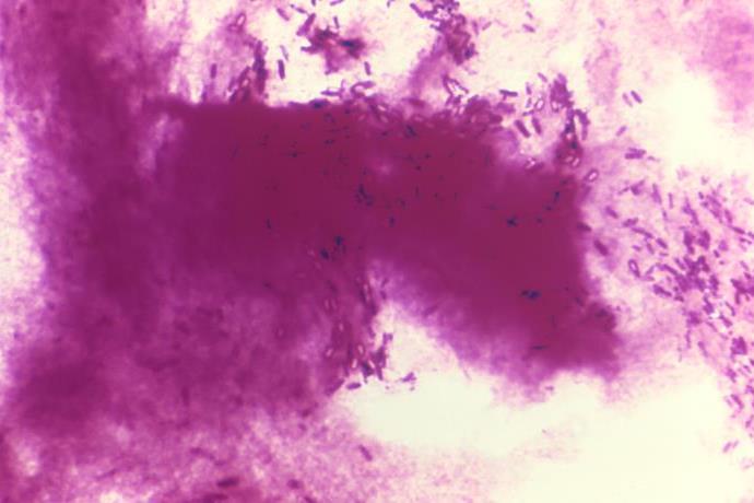 Sensor controls how dormant bacteria reawaken | The Microbiologist