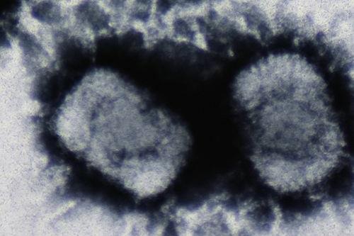A survival kit for smallpox viruses | News | The Microbiologist