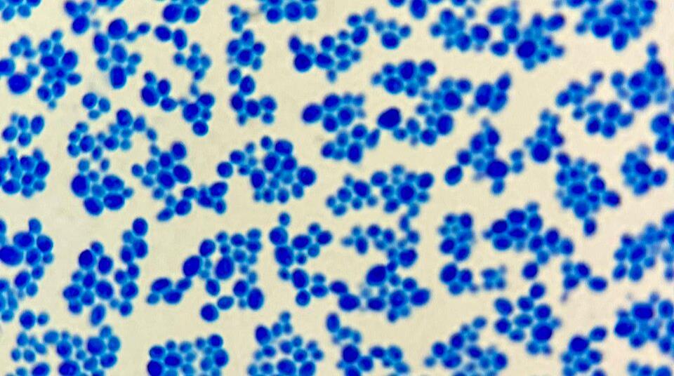 Mutated baker’s yeast at the forefront of petroleum substitute tech ...