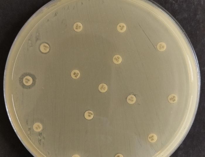 Multidrug-resistant bacterium posing a global public health threat is ...