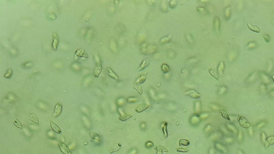 Predatory soil protists may boost PGPB activity | The Microbiologist