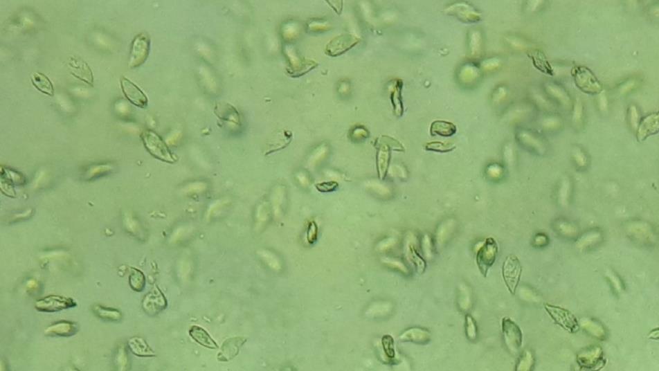 Predatory soil protists may boost PGPB activity | The Microbiologist