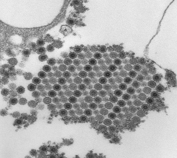 Study reveals how the chikungunya virus deploys multiple organ attack ...