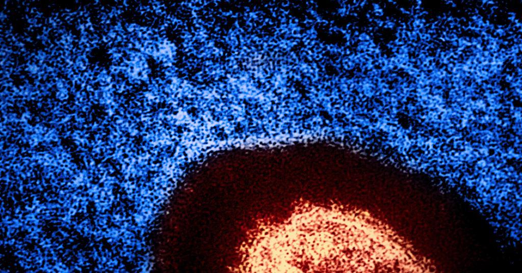 Measles cases surge worldwide, infecting 10.3 million people in 2023 ...