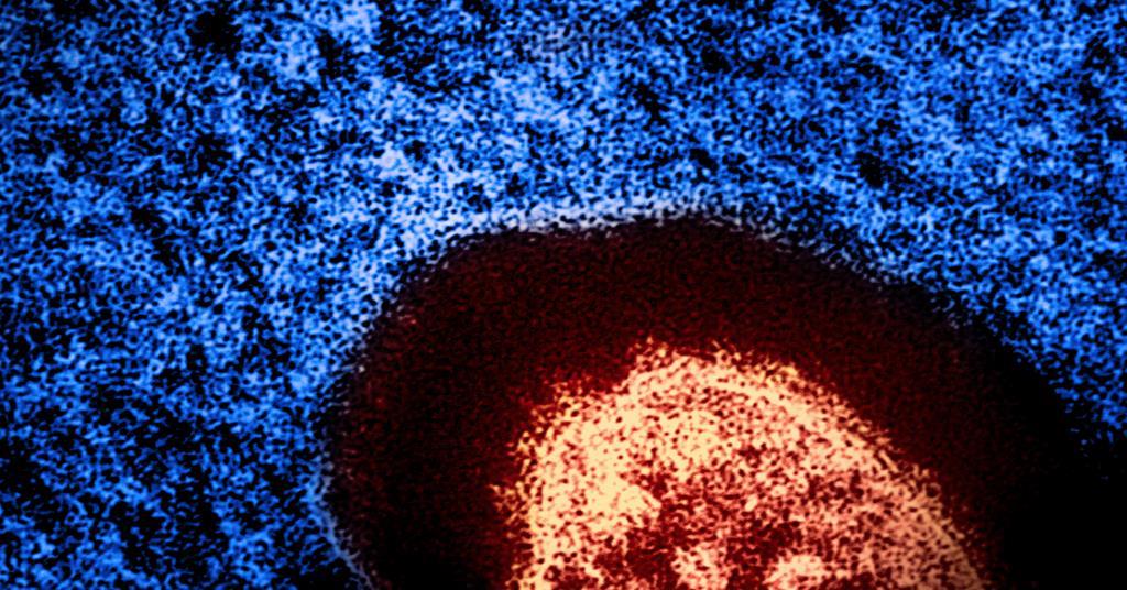 Measles cases surge worldwide, infecting 10.3 million people in 2023 ...