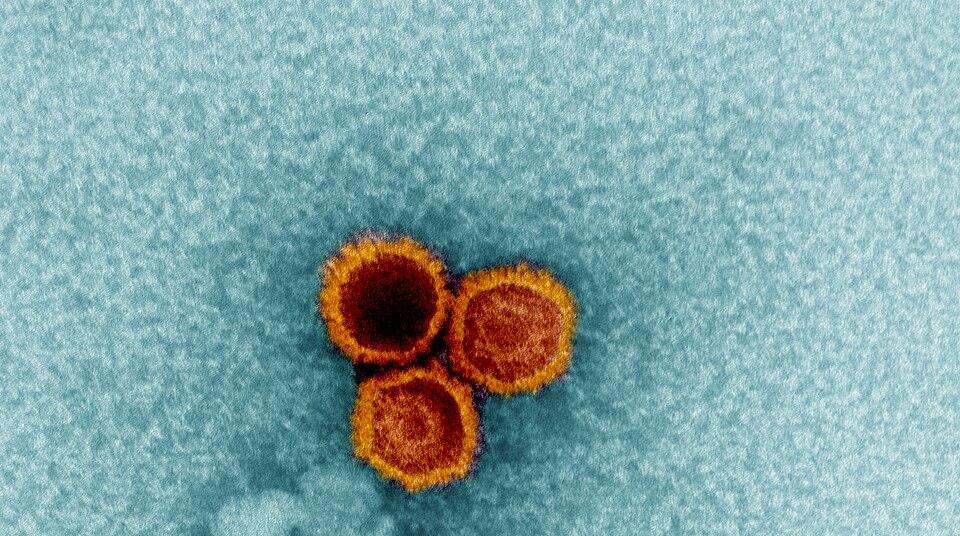 Scientists develop first-of-its-kind antibody to block Epstein Barr ...