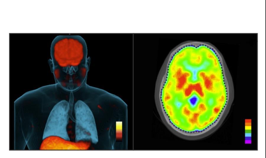 FDA-approved TB regimen may not work against deadliest form of TB | The ...