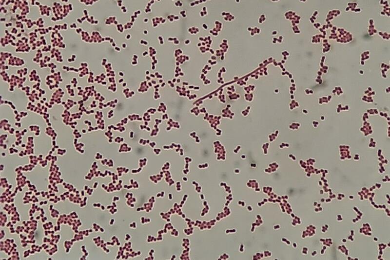 Zinc deficiency promotes Acinetobacter lung infection: study | News ...