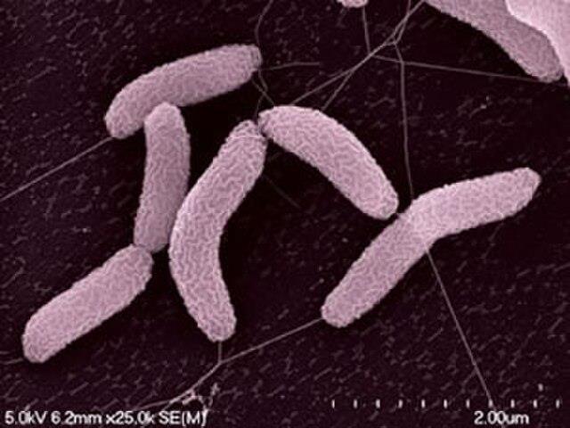 Desulfovibrio implicated in Parkinson’s disease | The Microbiologist