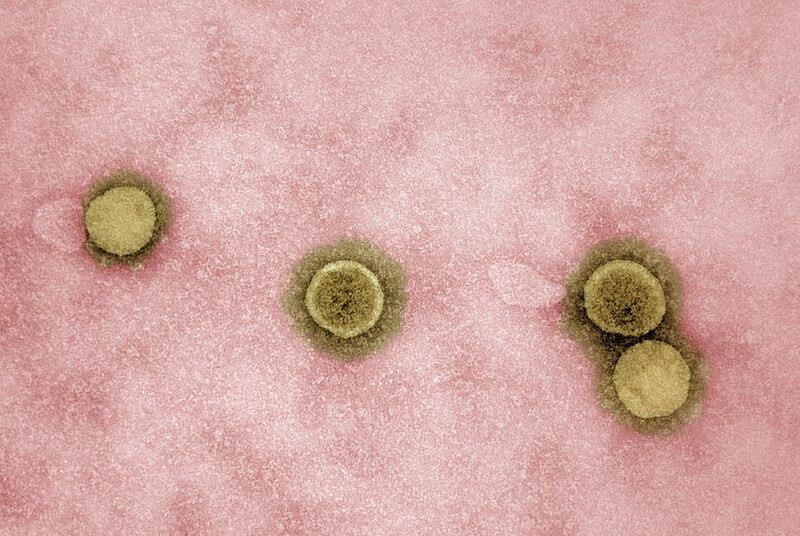 Inhaled COVID vaccine study begins recruitment for phase-2 human trials ...