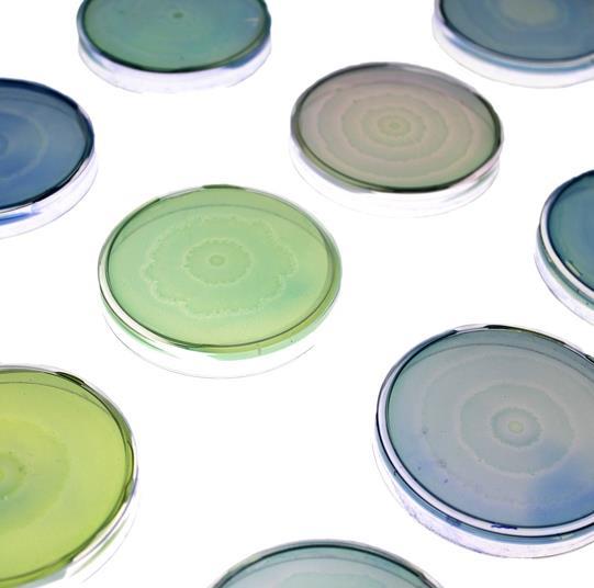 Pattern-forming bacteria used with AI as sensors | The Microbiologist