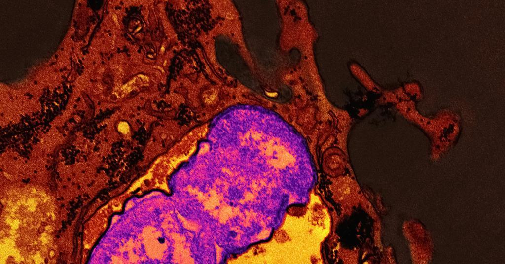 Vaccine development program aims to prevent sepsis in newborns | News ...