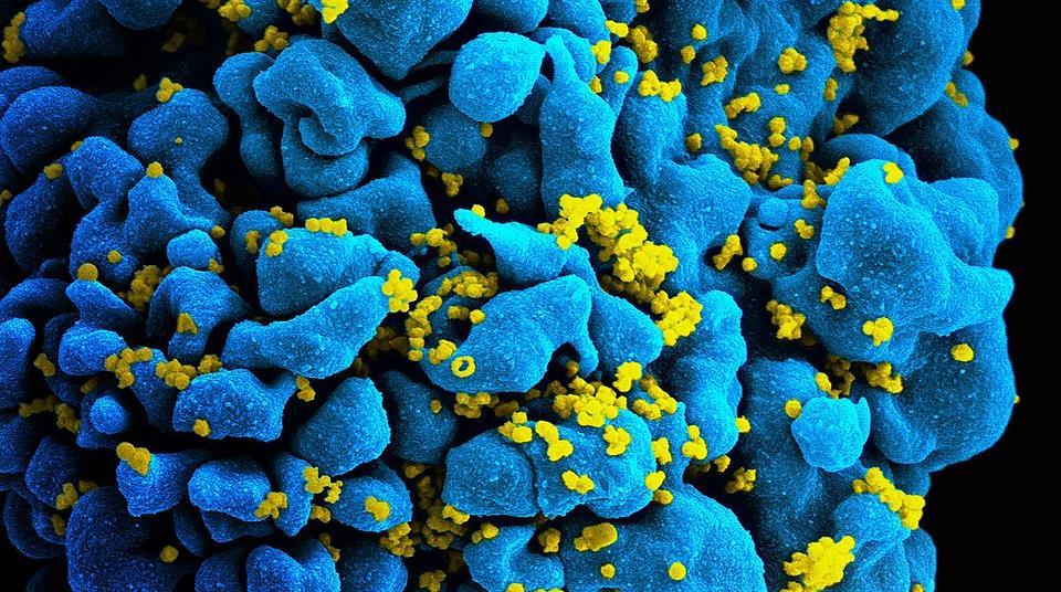 U.S. Public Health Service releases new guidelines on occupational HIV ...