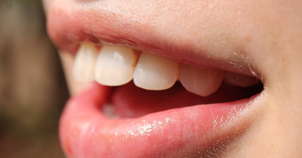 Rapid specific detection of oral pathogens using CRISPR-based ...