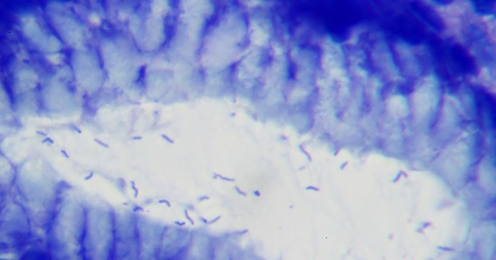 Researchers use 3D models to investigate movement of Helicobacter ...