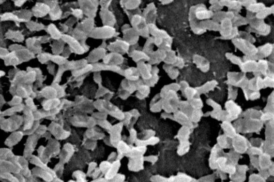 Artificial bladders shine light on bugs that cause urinary tract ...