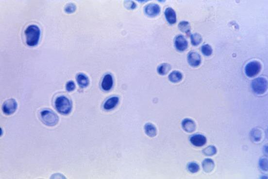 Intestinal bacteria influence the growth of fungi | The Microbiologist